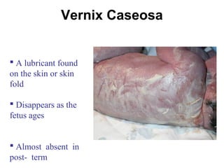 Neonatal examination | PPT