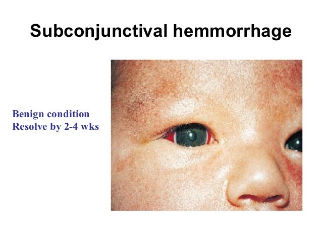 Neonatal examination