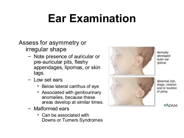 Neonatal examination