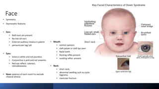 neonatal examination, ballard score cth 1.pptx