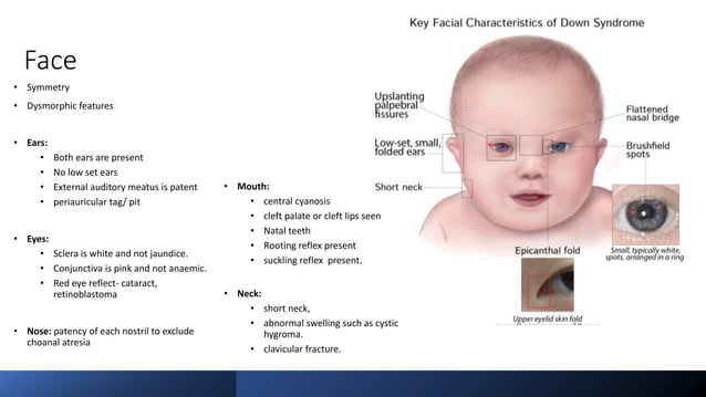 neonatal examination, ballard score cth 1.pptx