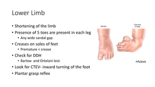 neonatal examination, ballard score cth 1.pptx | Blood Disorders ...
