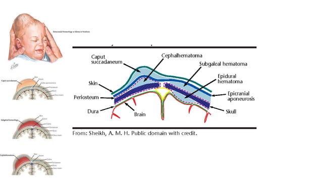 neonatal examination, ballard score cth 1.pptx