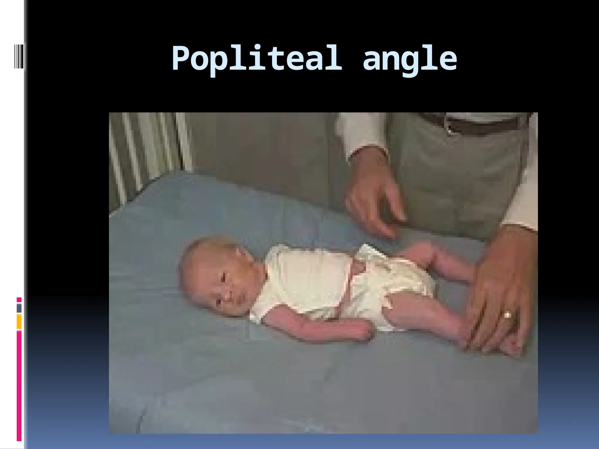 Neonatal gestational age calcualtions pic | PPTX