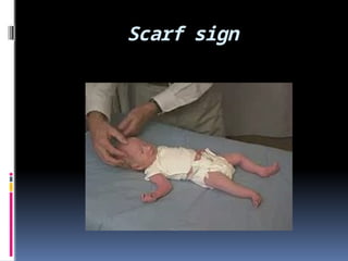 Neonatal gestational age calcualtions pic | PPT