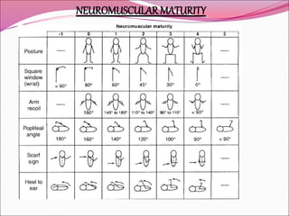 Neonatal Gestational Age Assessment.ppt