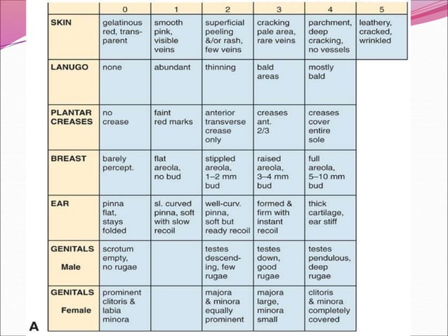 Neonatal Gestational Age Assessment.ppt