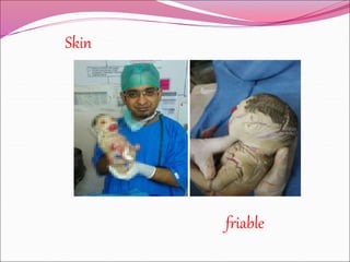 Neonatal Gestational Age Assessment.ppt