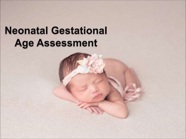 Neonatal Gestational Age Assessment.ppt
