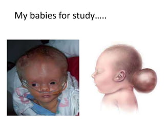 Neonatal head usg | PPT