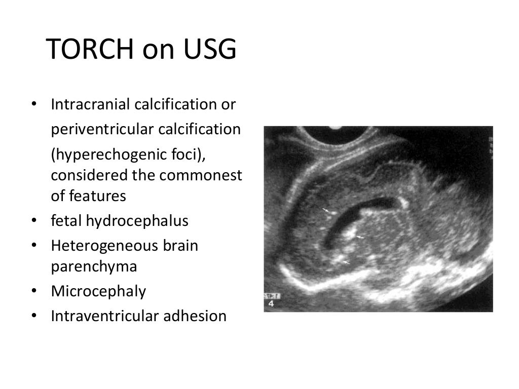 Neonatal head usg