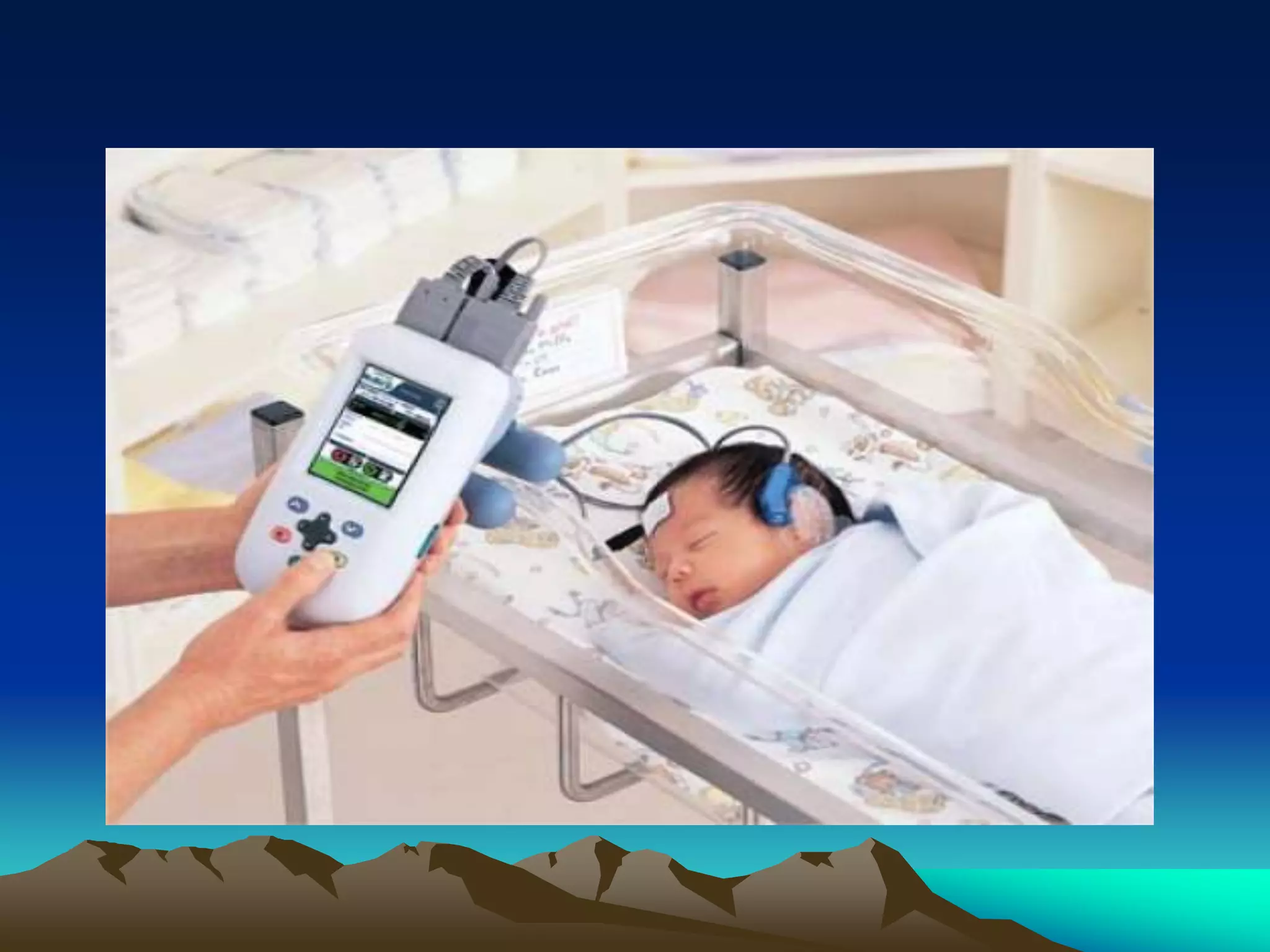 Neonatal hearing screening | PPT