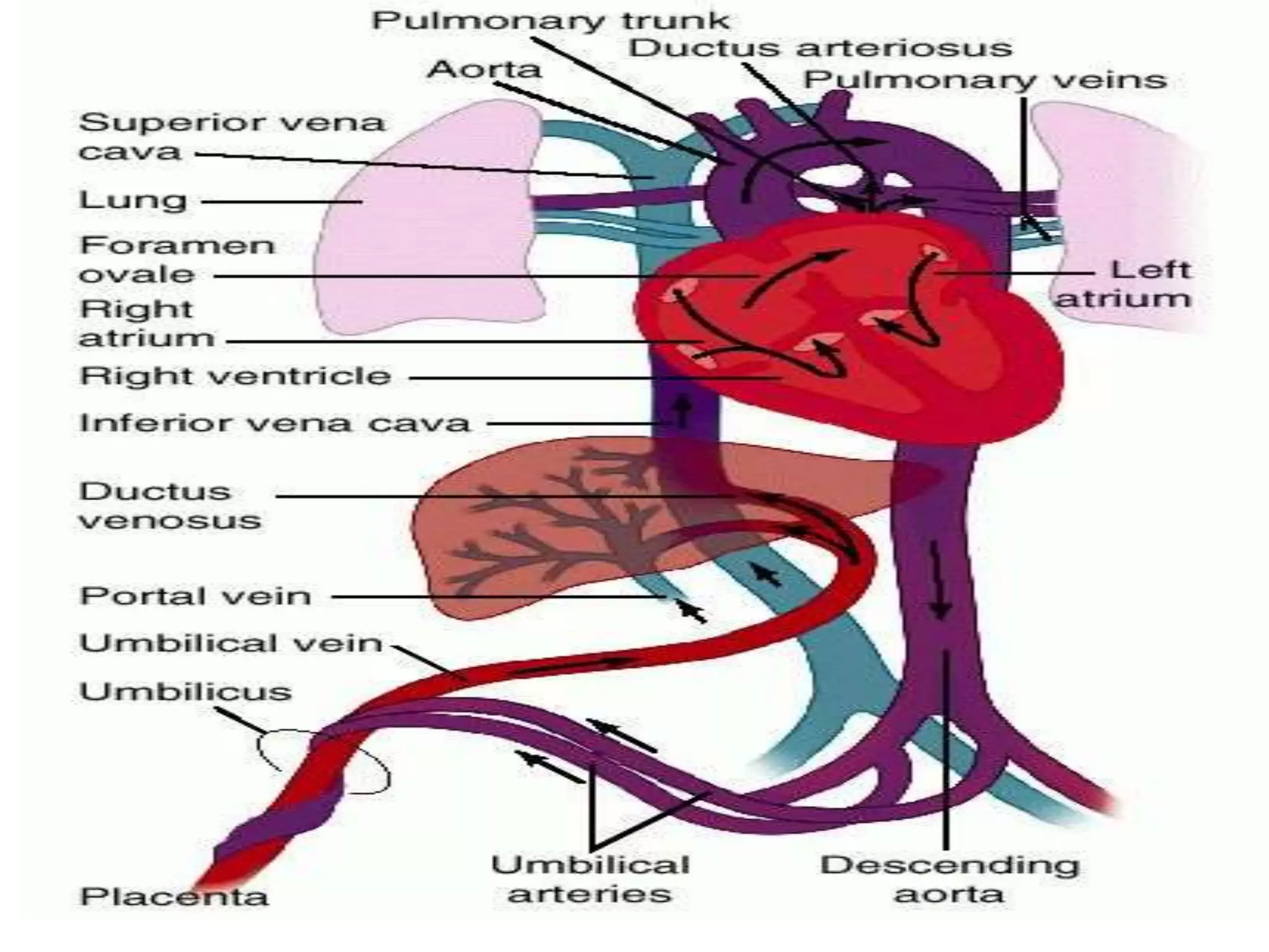 Neonatal heart diseases | PPTX