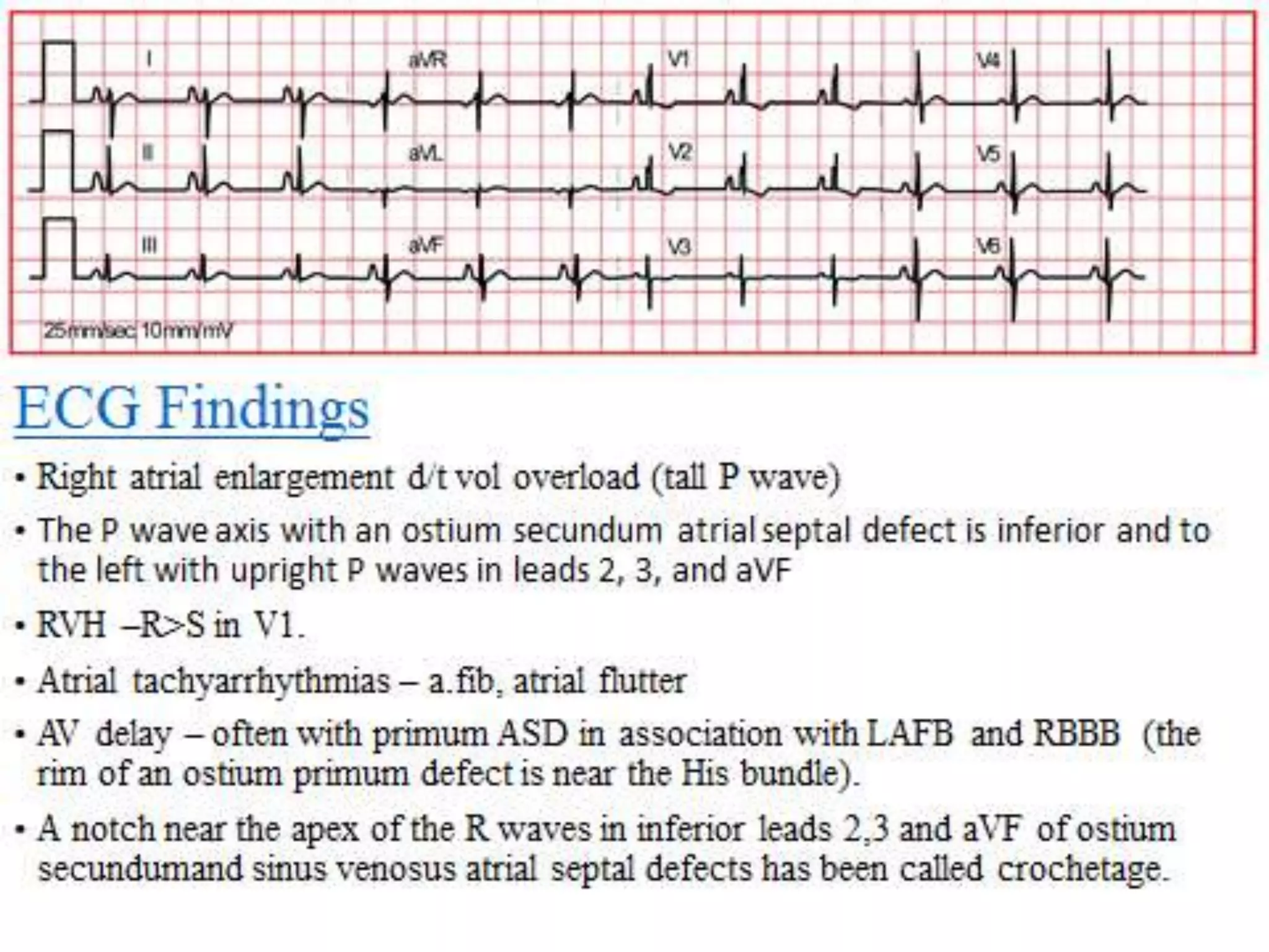 Neonatal heart diseases | PPTX