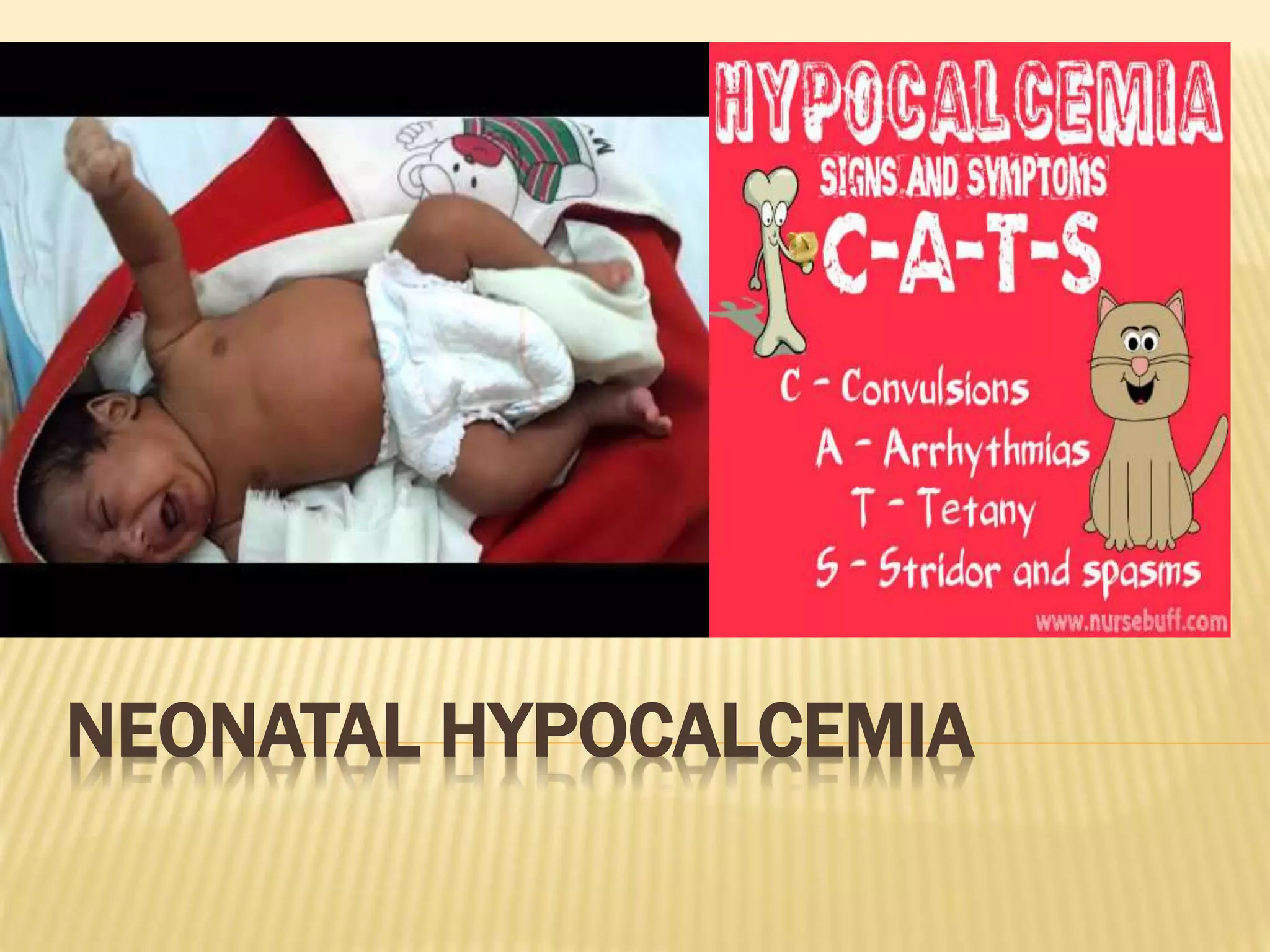 Neonatal hypocalcemia | PPTX