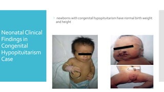 Neonatal hypopituitarism approaches to diagnosis and treatment | PPTX
