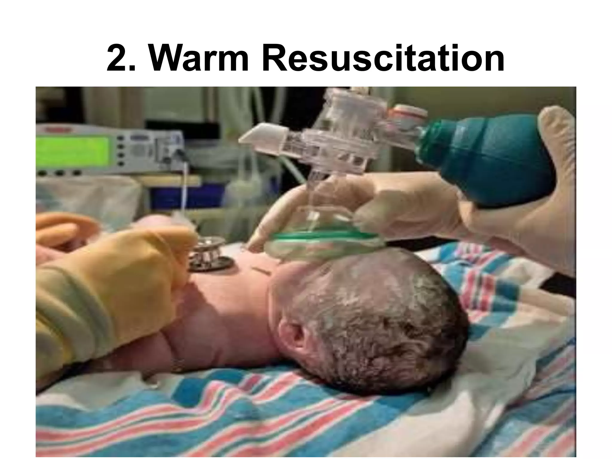 Neonatal hypothermia | PPTX