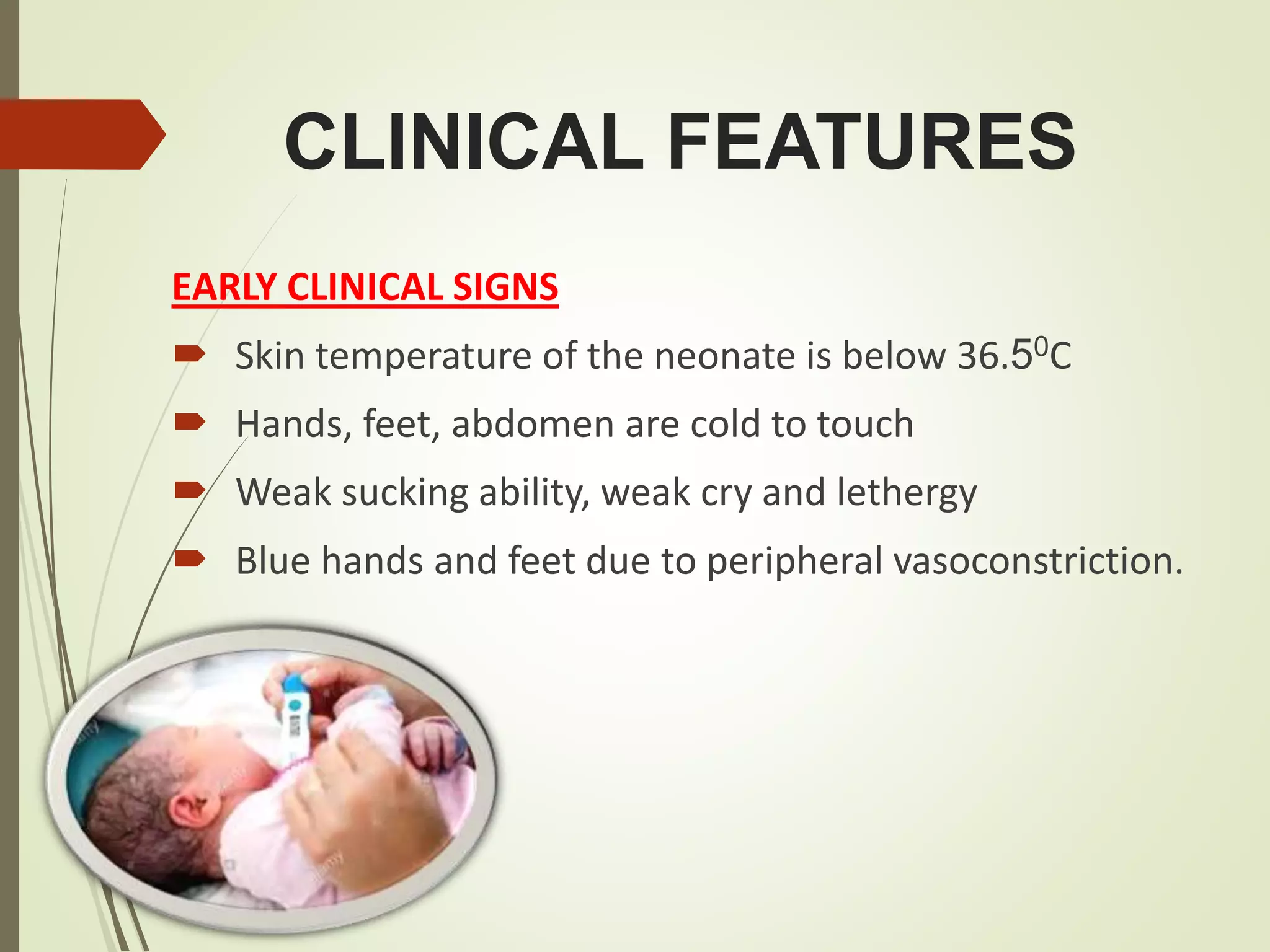 Neonatal hypothermia | PPTX