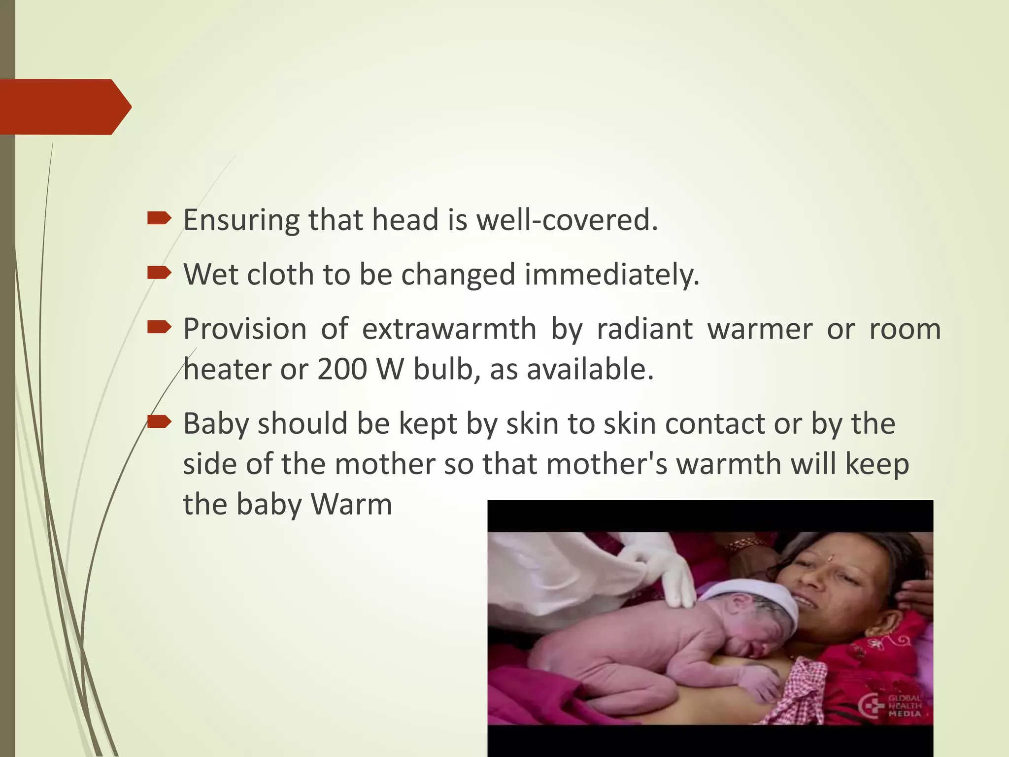 Neonatal hypothermia | PPTX