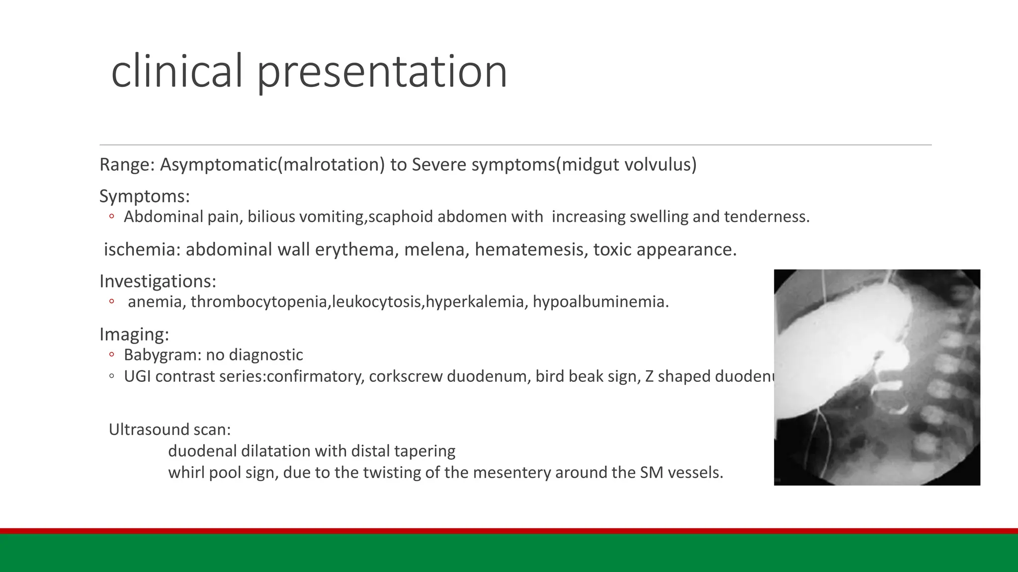 neonatal Intestinal obstruction; etiology, diagnosis and management.pptx