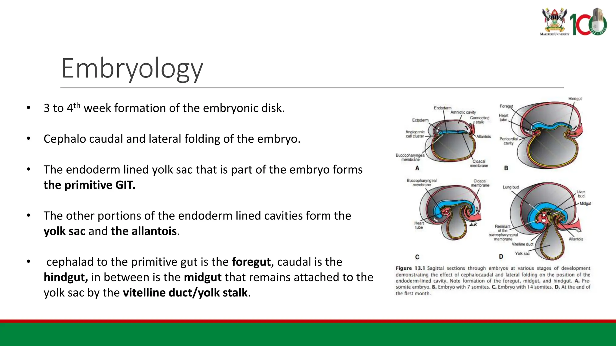 neonatal Intestinal obstruction; etiology, diagnosis and management.pptx