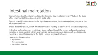 neonatal Intestinal obstruction; etiology, diagnosis and management.pptx