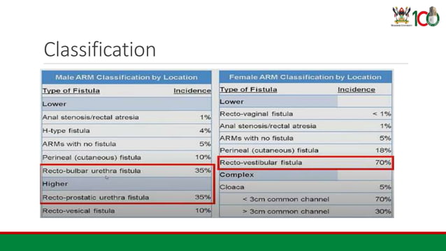 neonatal Intestinal obstruction; etiology, diagnosis and management.pptx