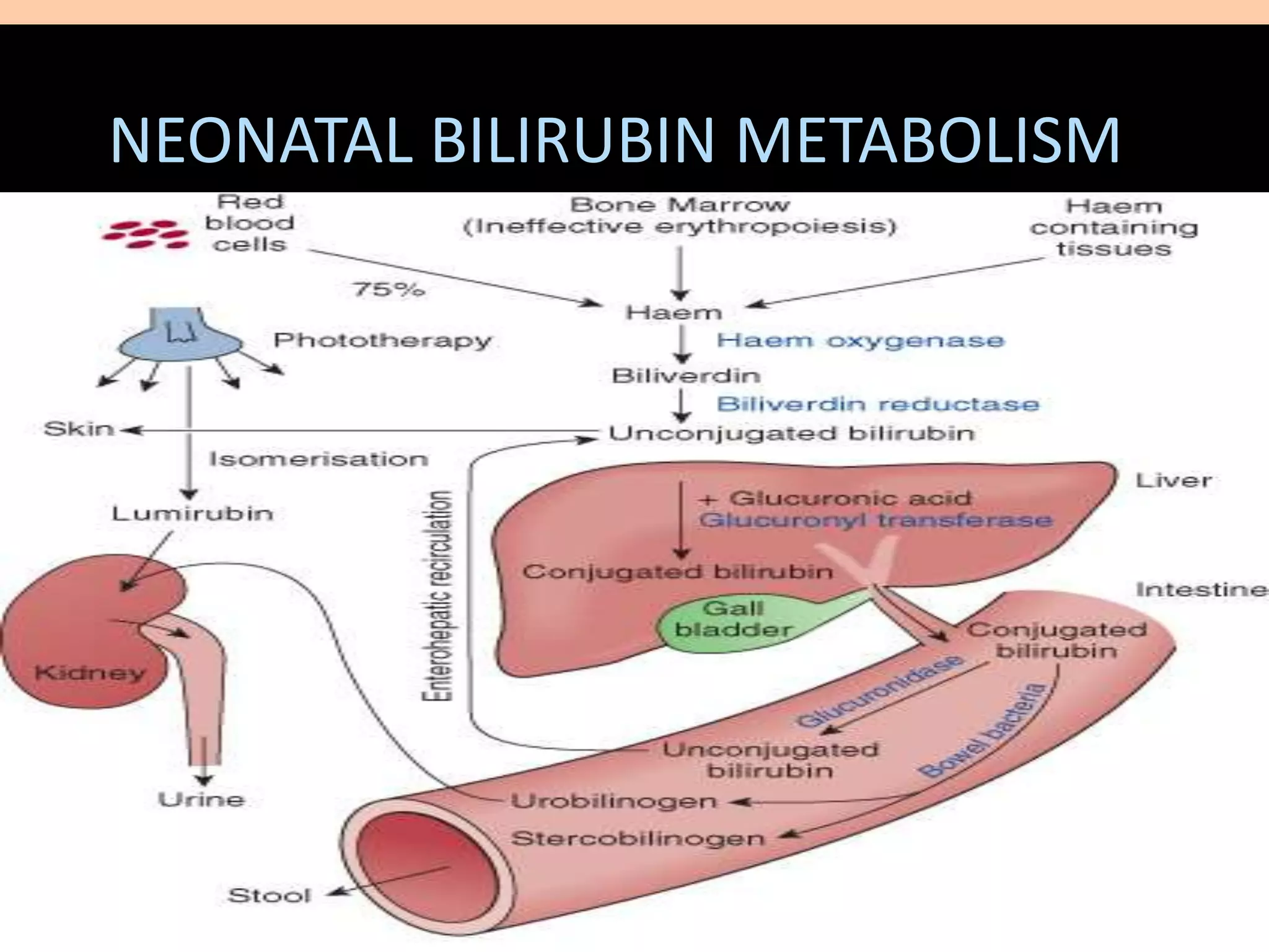 Neonatal icterus.pptx