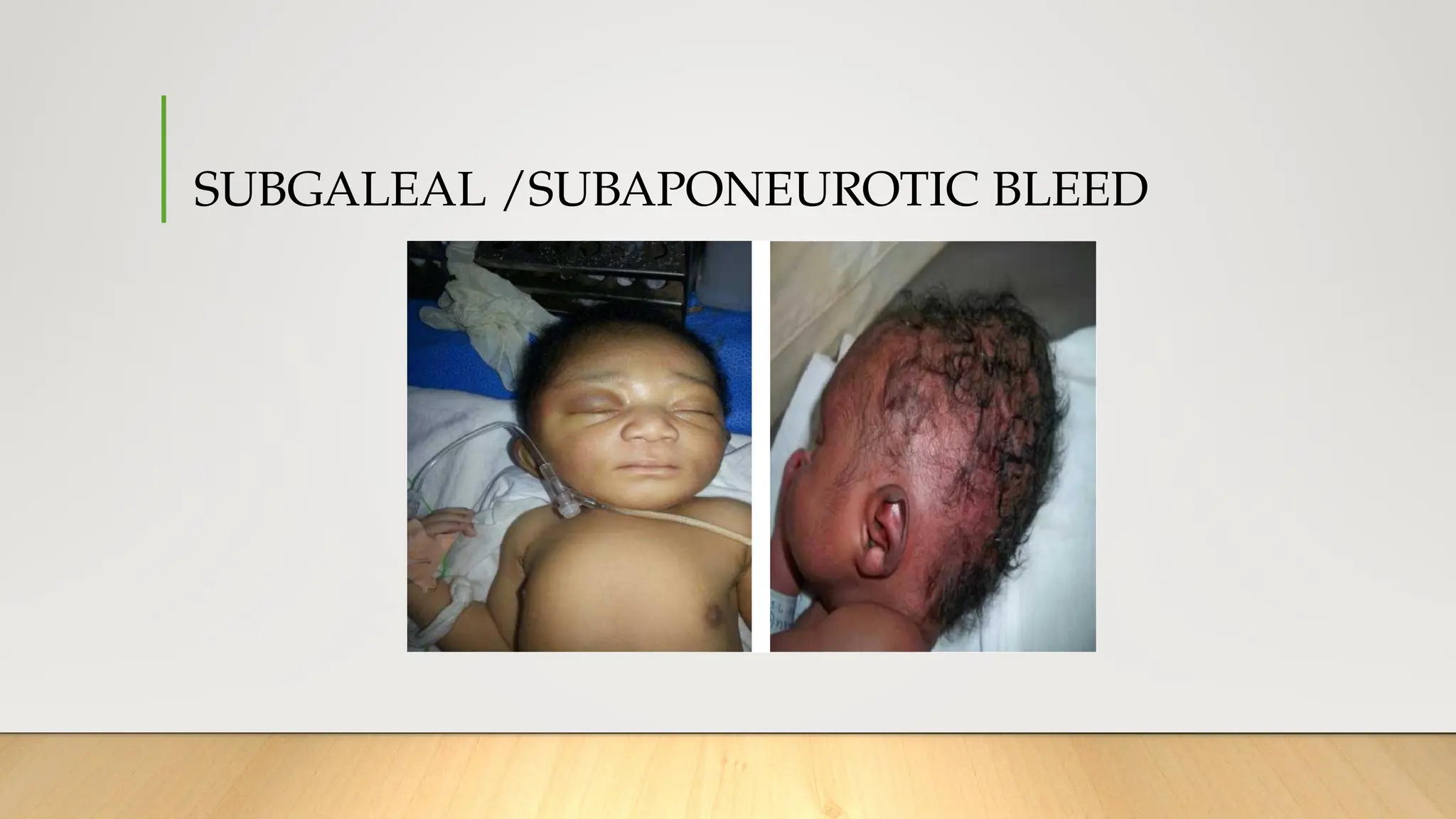 NEONATAL INFECTION AND BIRTH INJURIES.pptx