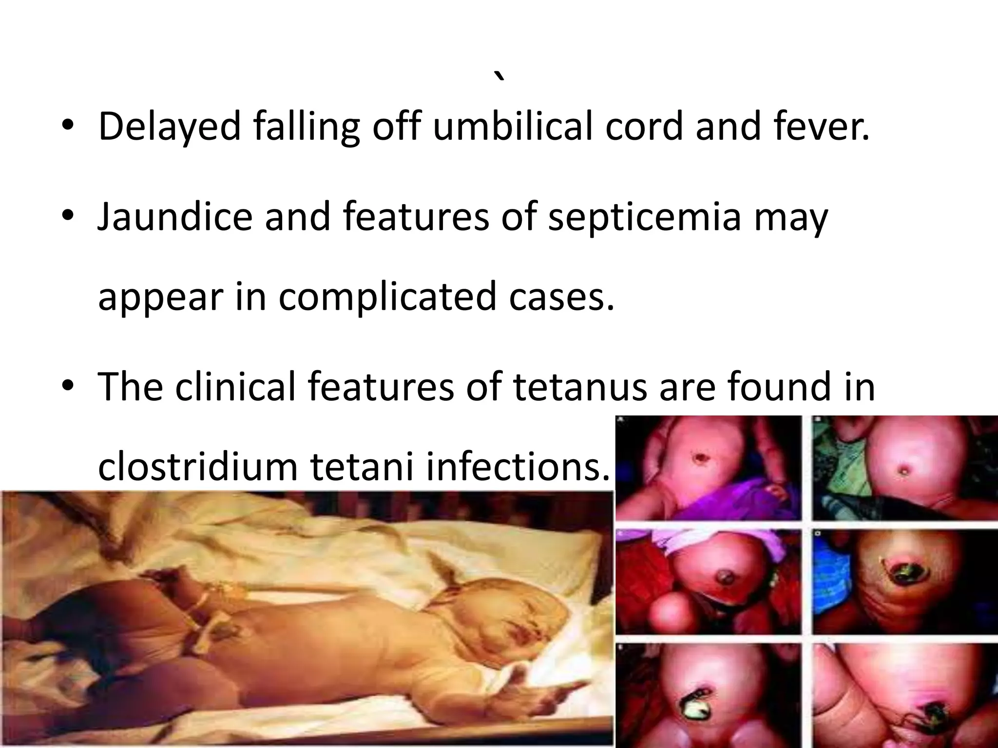 Neonatal infections | PPTX