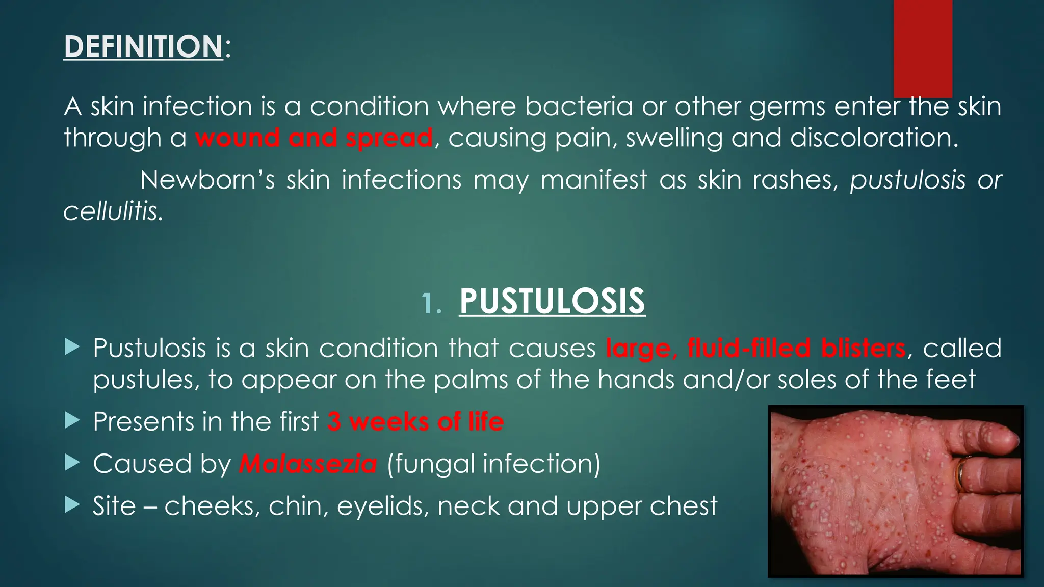 neonatal infections/infections in newborn.pptx