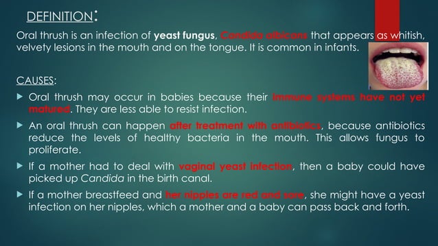 neonatal infections/infections in newborn.pptx