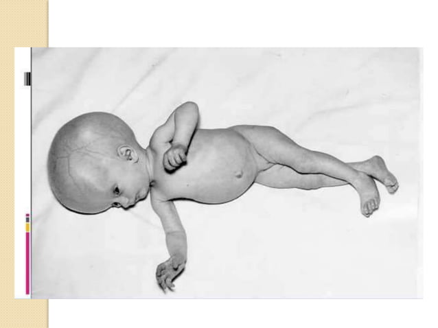 neonatal infectious diseases categories.pptx