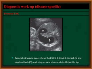 Neonatal intestinal obstruction | PPTX
