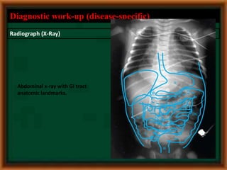 Neonatal intestinal obstruction | PPTX