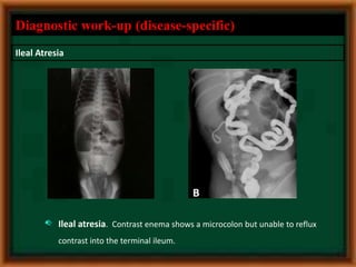 Neonatal intestinal obstruction | PPTX | Digestive Disorders | Diseases ...