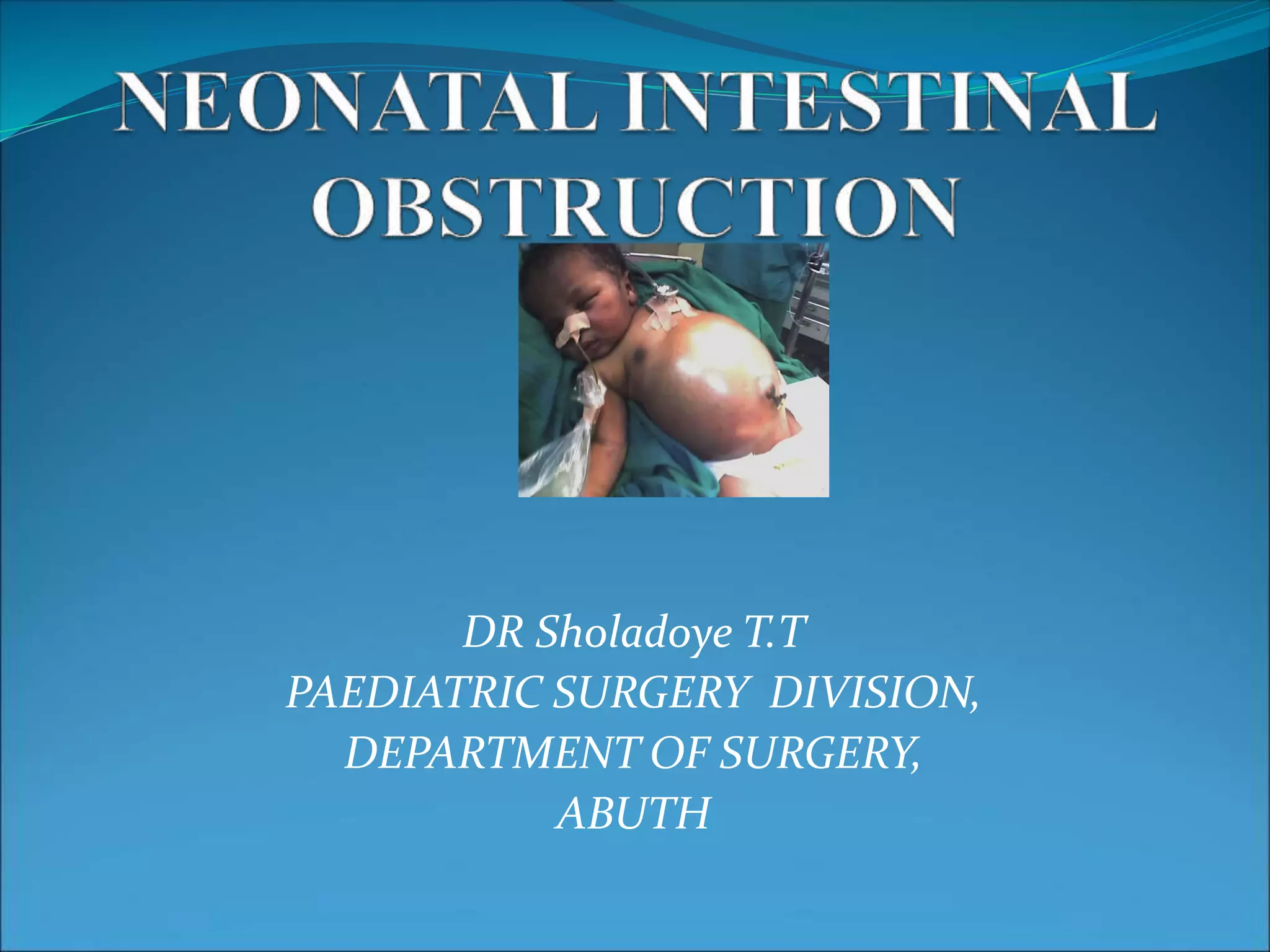 neonatal intestinal obstruction.ppt