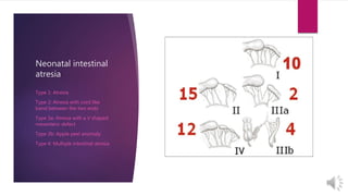 Neonatal intestinal obstruction ppt 6 th year | PPTX