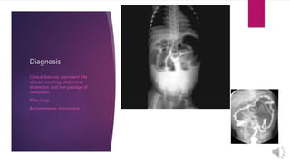 Neonatal intestinal obstruction ppt 6 th year | PPTX