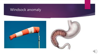 Neonatal intestinal obstruction ppt 6 th year | PPTX