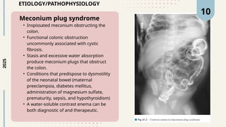 NEONATAL IO-1.pptx peadiatric emergencies | PPT
