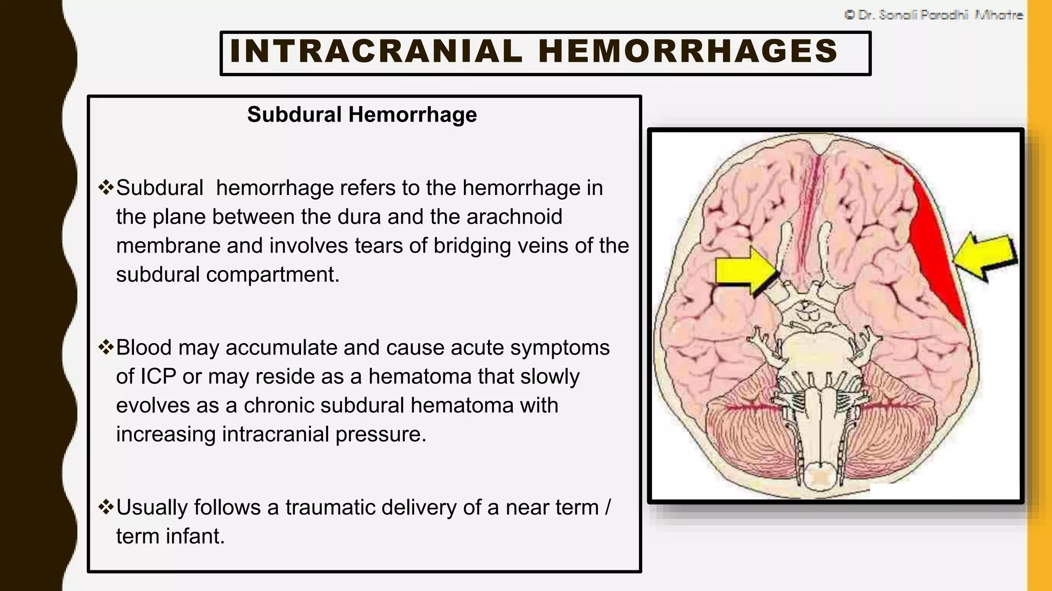 Neonatal Intracranial Hemorrhage - by dr. Sonali Mhatre | PPTX