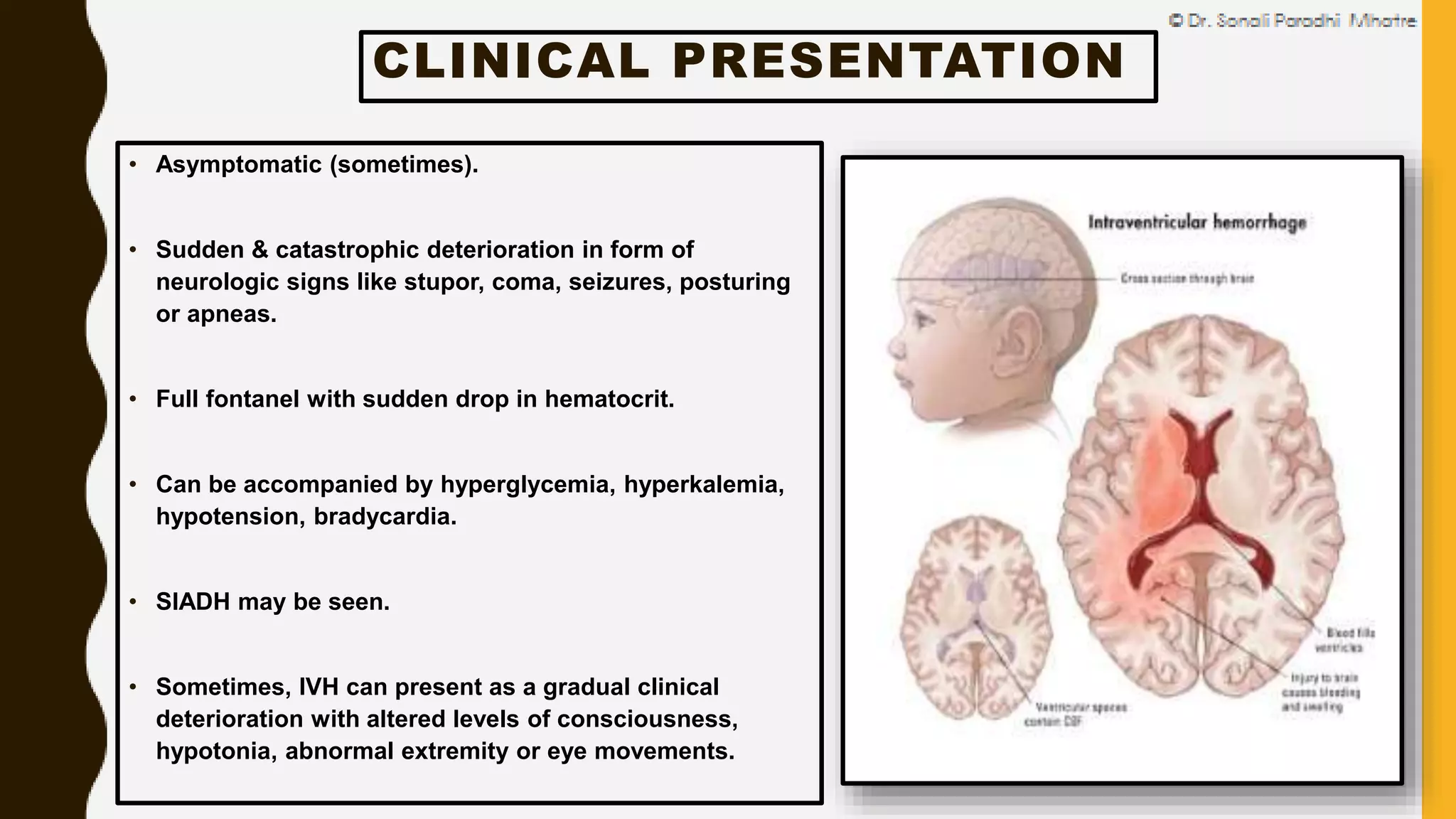 Neonatal Intracranial Hemorrhage - by dr. Sonali Mhatre | PPTX