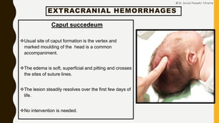 Neonatal Intracranial Hemorrhage - by dr. Sonali Mhatre | PPTX | Death ...