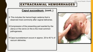 Neonatal Intracranial Hemorrhage - by dr. Sonali Mhatre | PPTX