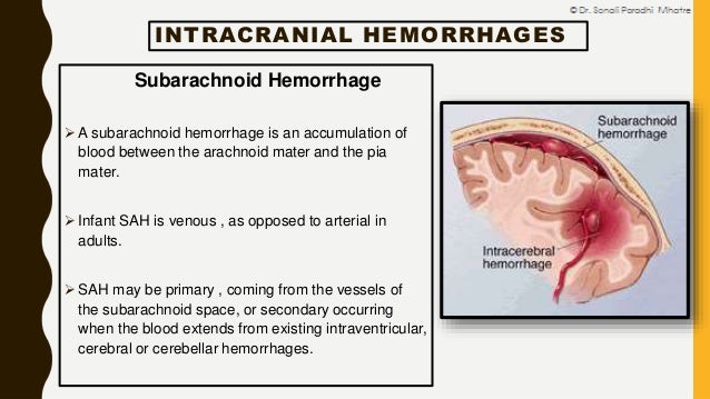 Neonatal Intracranial Hemorrhage By Dr Sonali Mhatre