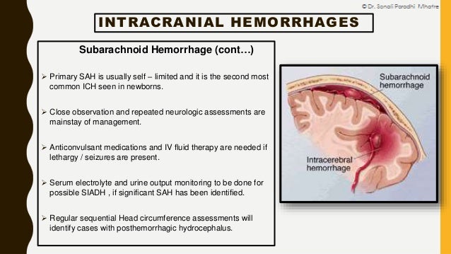 Intraventricular Hemorrhage Newborn