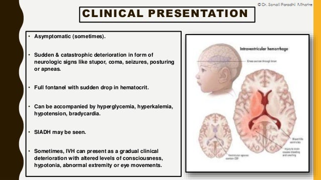 Intraventricular Hemorrhage Newborn
