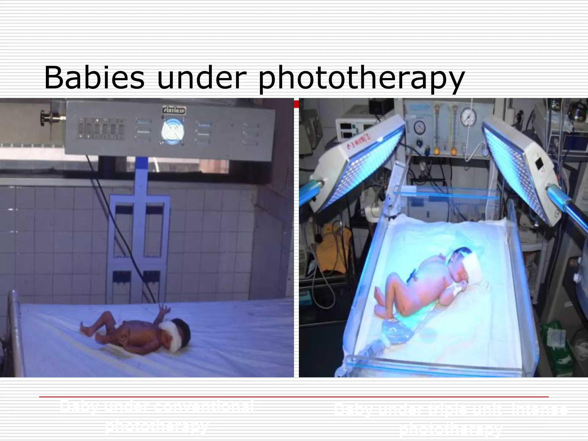 NNJ | PPSX | Blood Disorders | Diseases and Conditions