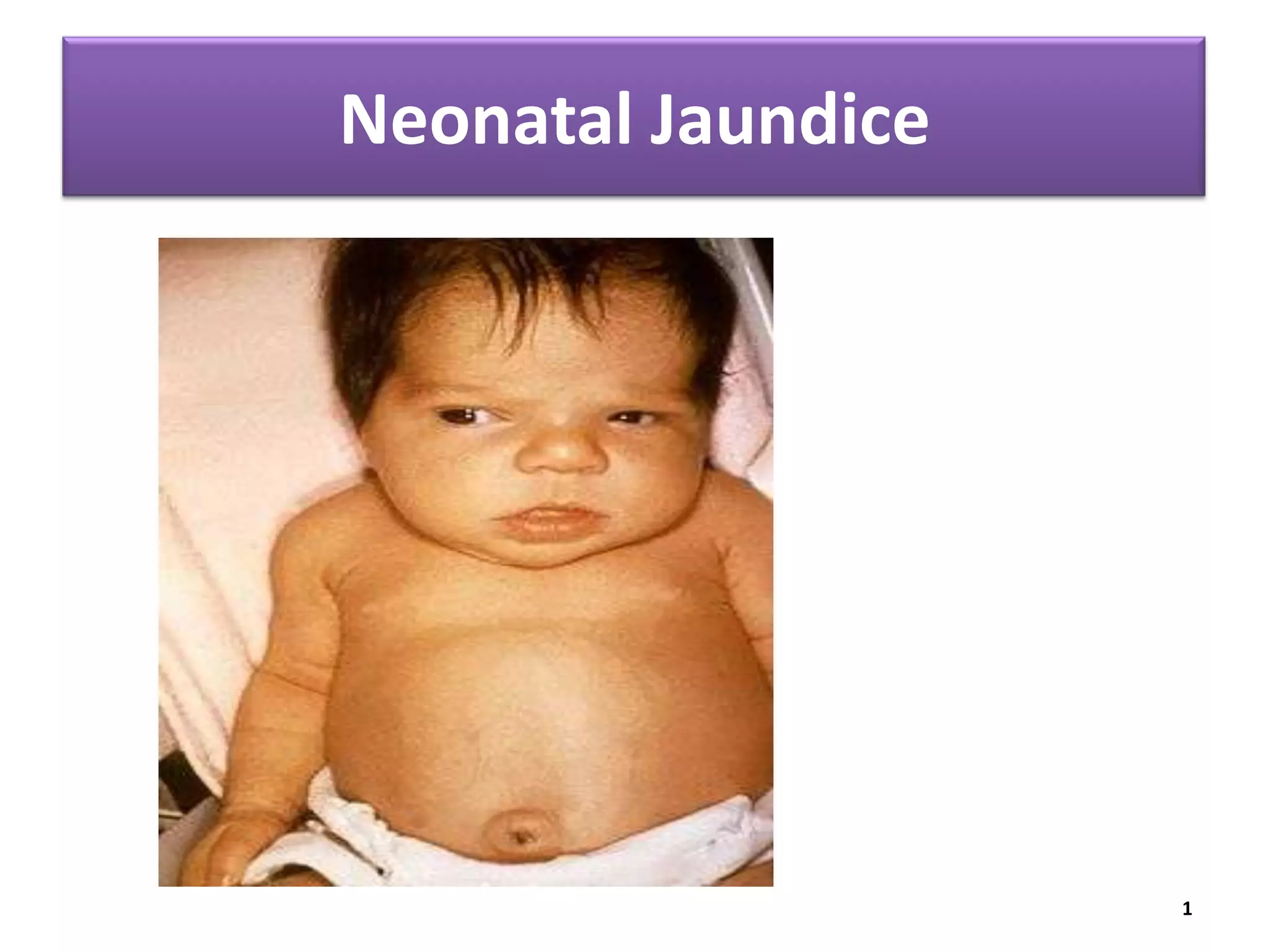 Neonatal Jaundice | PPTX